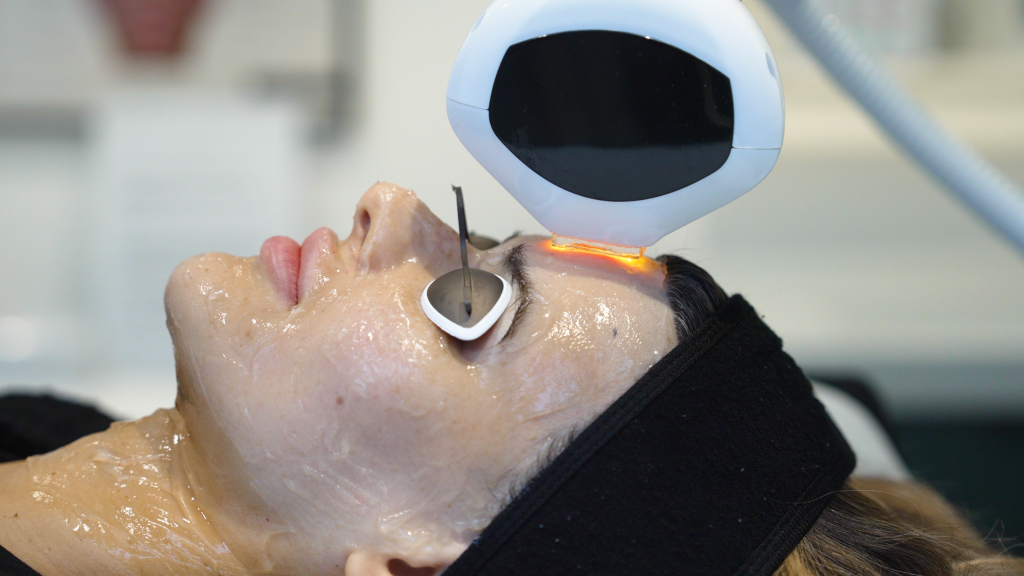 Lumecca IPL Treatment | Skin Rejuvenation & Pigmentation